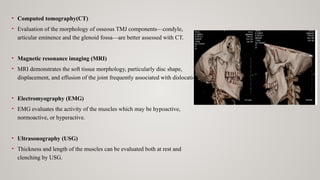 RECURRENT DISLOCATION OF TEMPOROMANDIBULAR JOINT | PPTX
