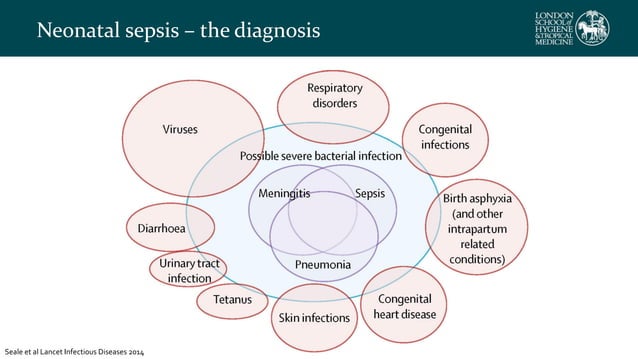Dr Anna Seale @ MRF's Meningitis and Septicaemia 2019 | PPT