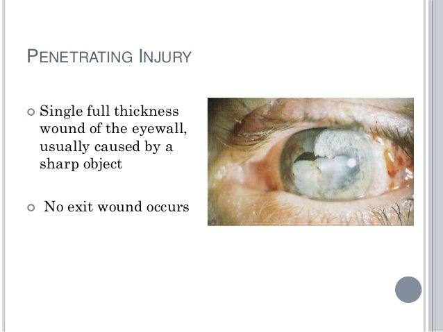 Penetrating Ocular Trauma