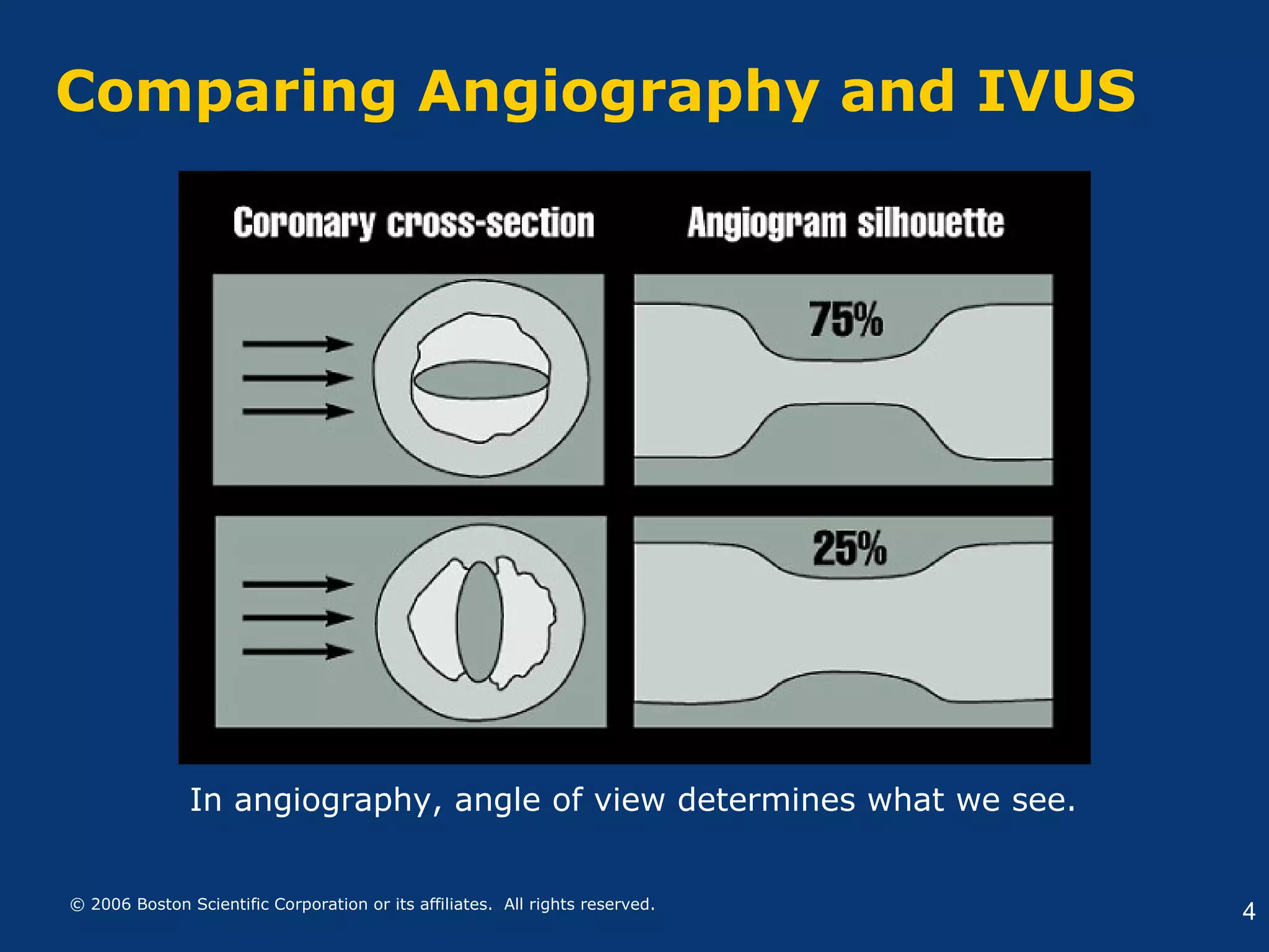 IVUS Image Interpretation and Analysis | PPT