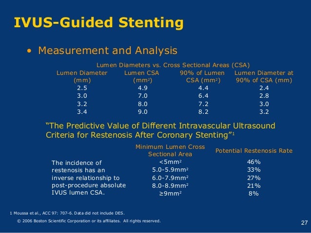 IVUS Image vInterpretation and Analysis