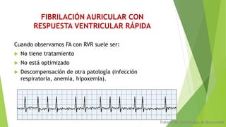 Fibrilacion auricular | PPTX