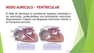 Fibrilacion auricular | PPTX