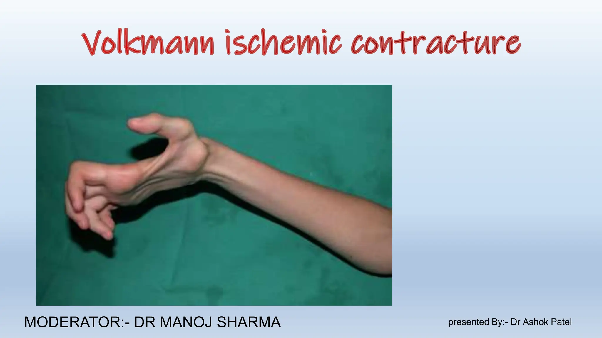 volkmann ischemic contracture orthopaedics.pptx