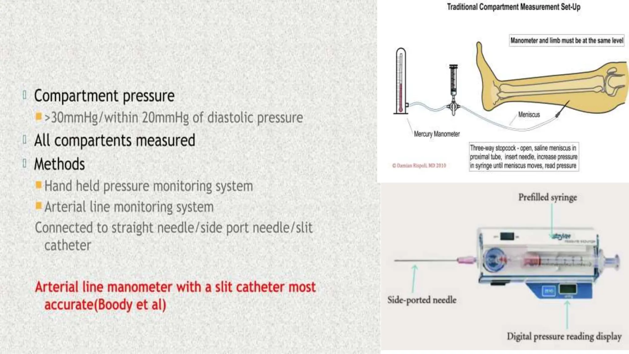 volkmann ischemic contracture orthopaedics.pptx