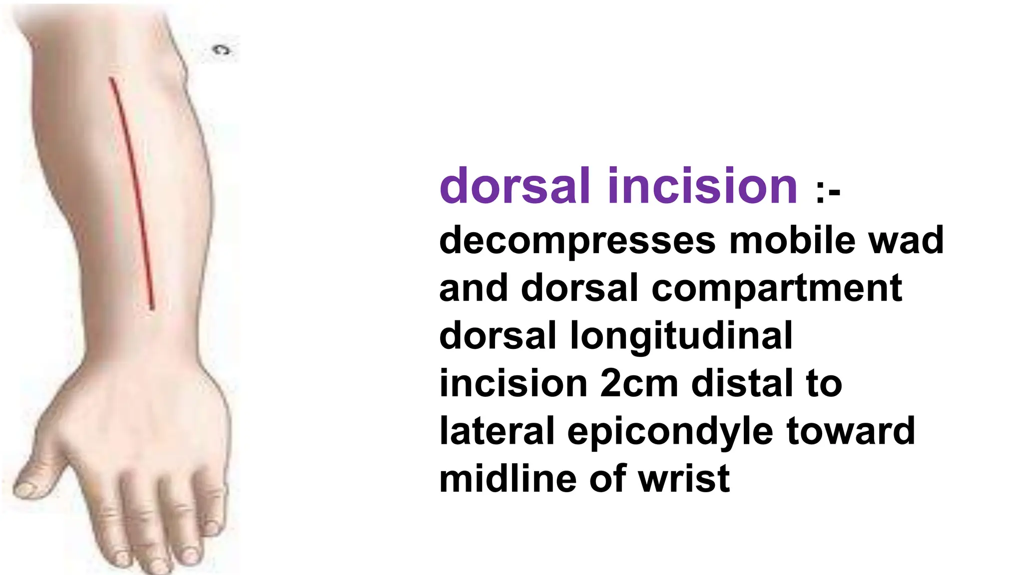 volkmann ischemic contracture orthopaedics.pptx