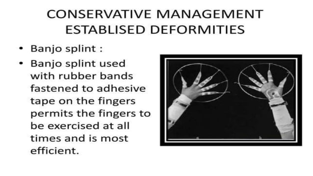volkmann ischemic contracture orthopaedics.pptx | First Aid | Injuries