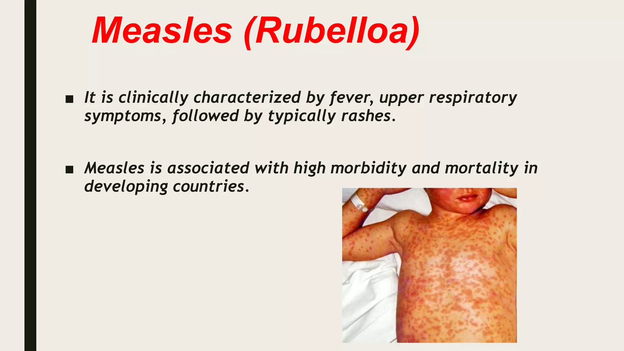 measles.pptx