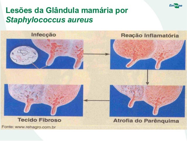 Mastite dos bovinos: identificação, controle e prevenção
