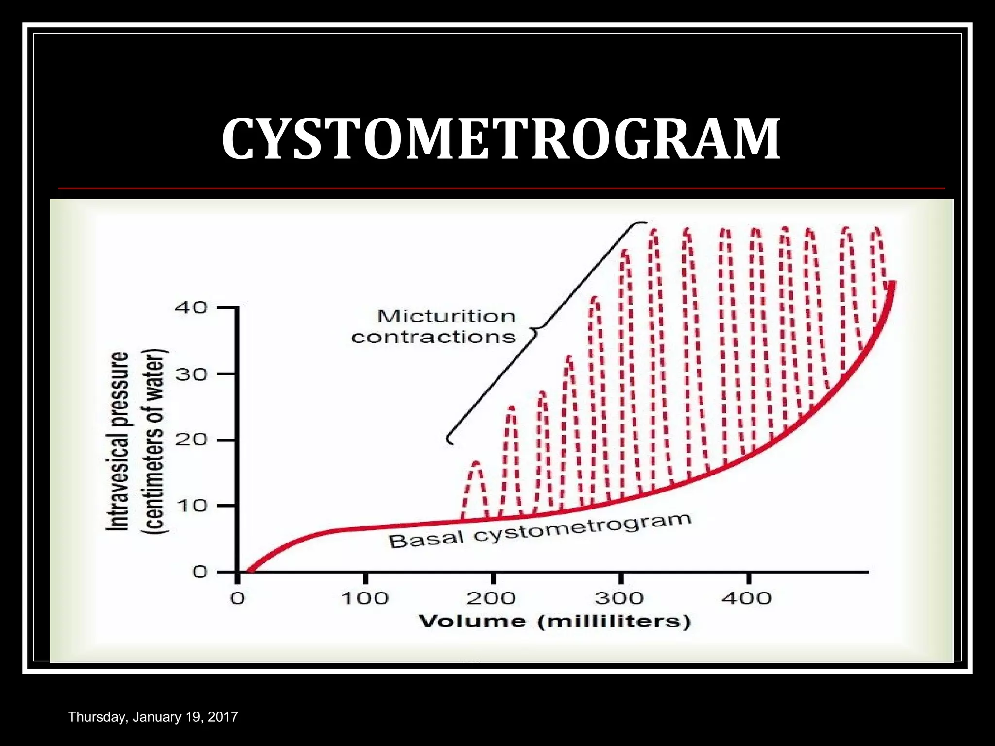 DRAW A NEAT DIAGRAM - EXCRETARY SYSTEM | PPT