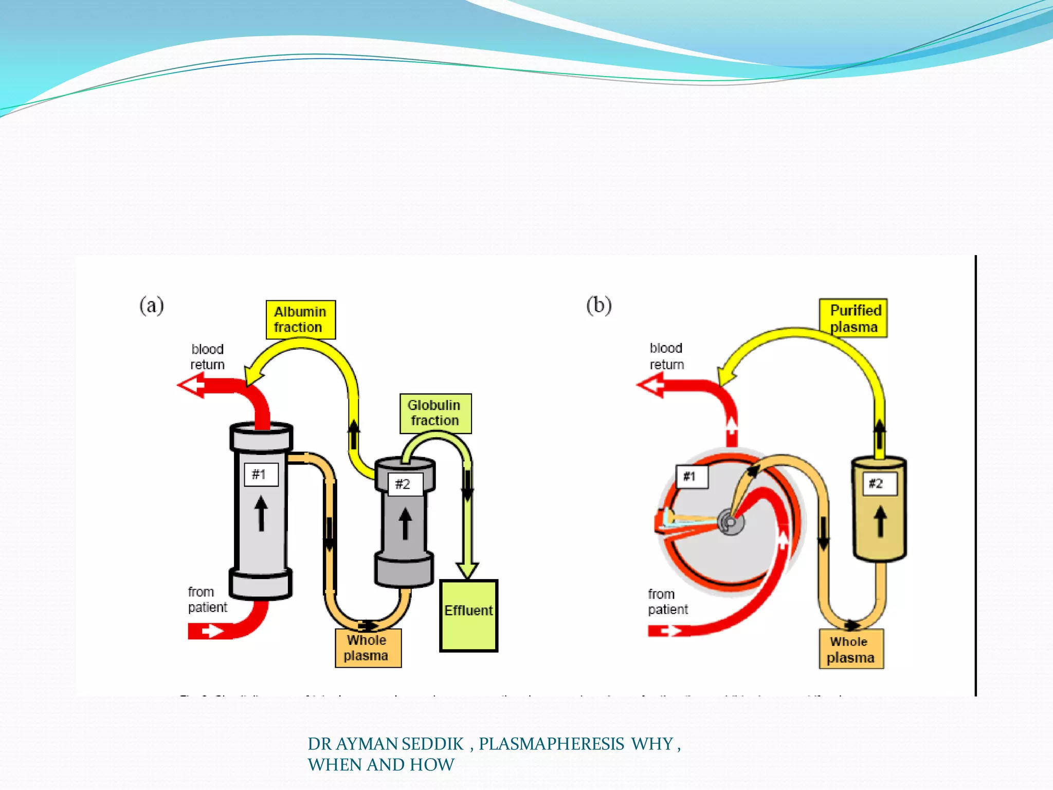 plasmapheresis WHY WHEN AND HOW | PDF