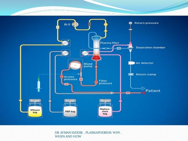 plasmapheresis WHY WHEN AND HOW
