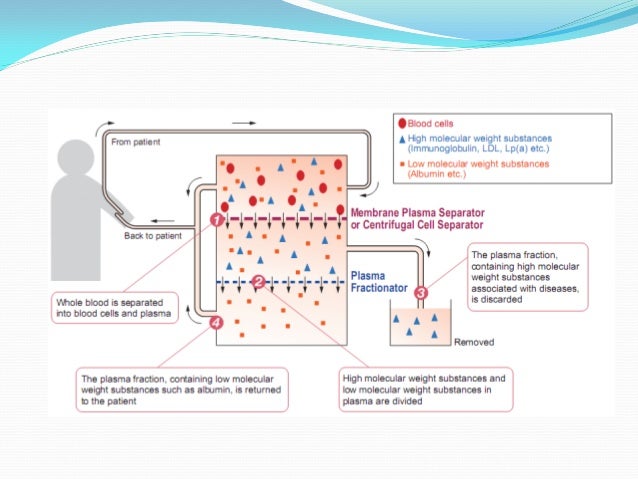 plasmapheresis WHY WHEN AND HOW