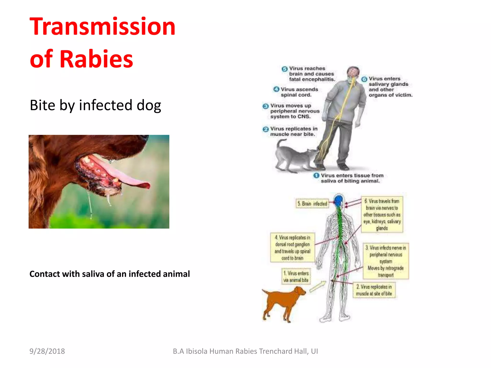 Human Rabies | PPTX