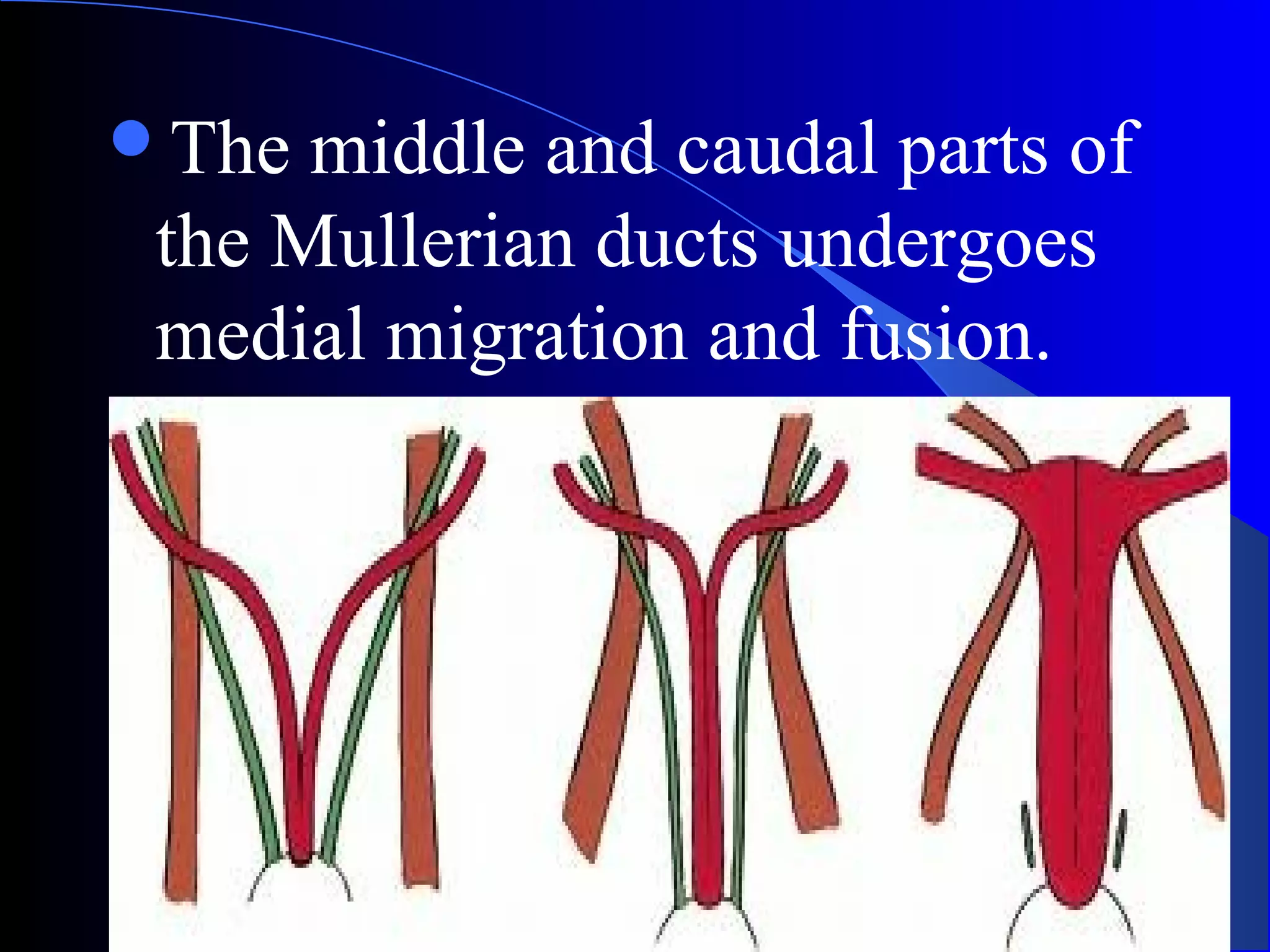 Embryology and congenital anomalies of female reproductive system for ...