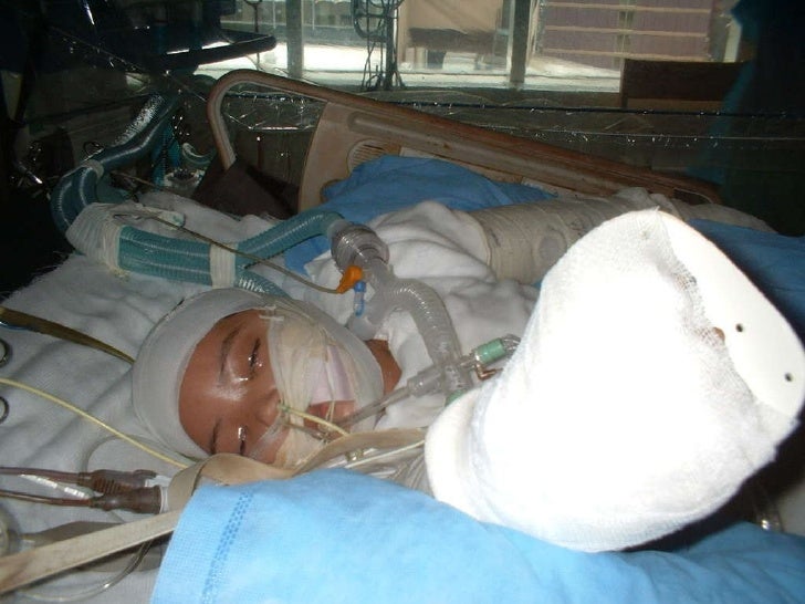 Nutricion en el Gran Quemado