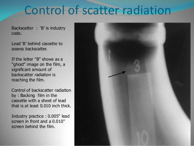 physical interaction of x ray with matter