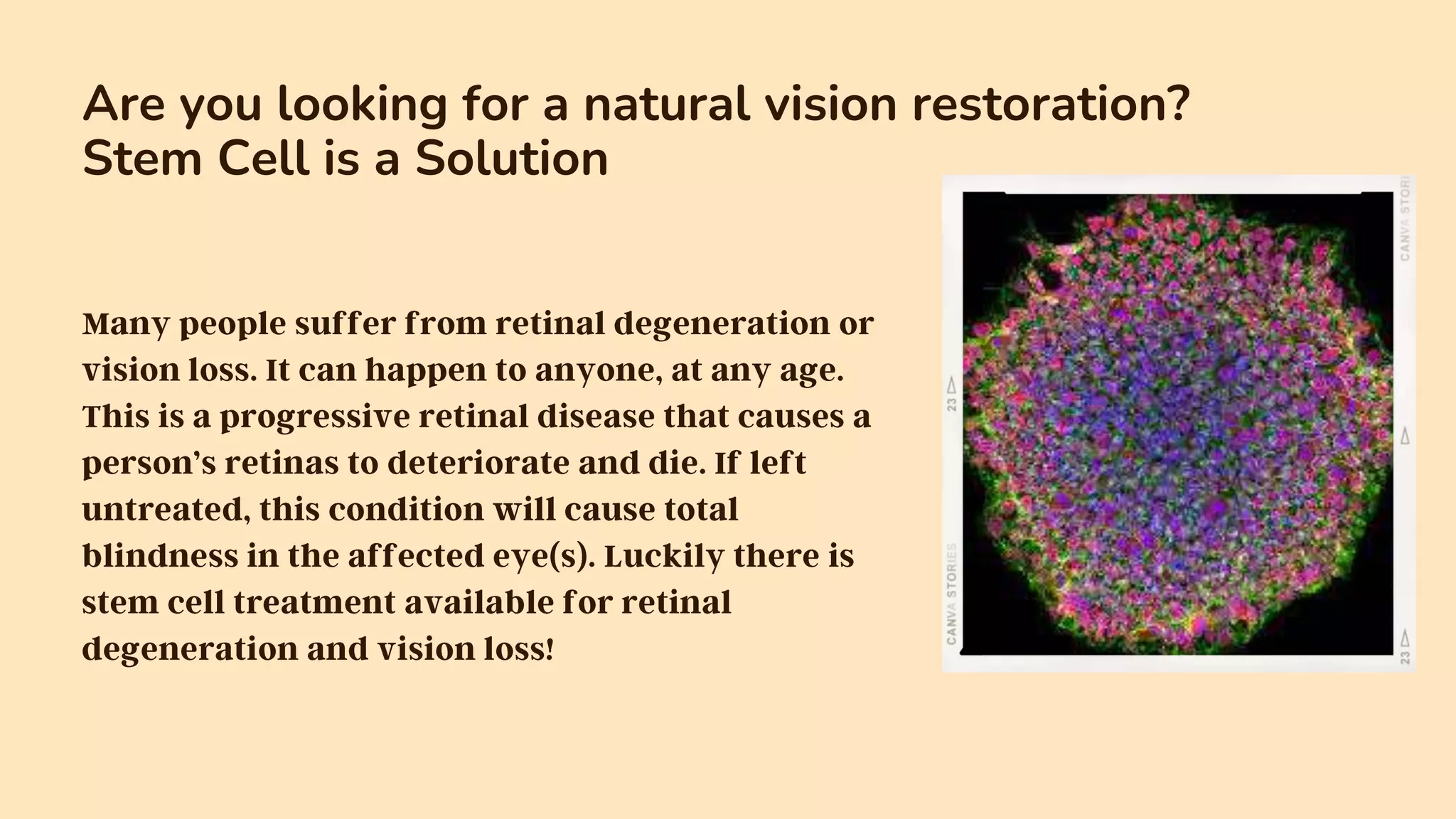 Dr David Green r3 Stem Cell Treatment for Retinal Degeneration.pptx