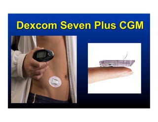 Dr david price dexcom | PPT