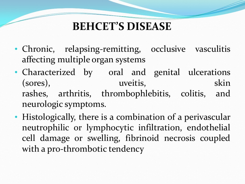 Behcet's disease