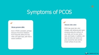 signs of PCOS | PPT