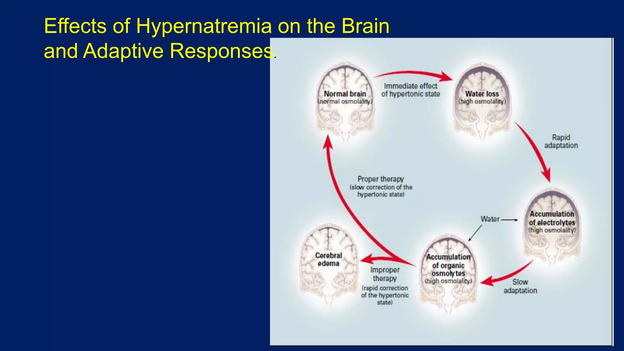 fluid therapy hypernatremia | PDF | First Aid | Injuries