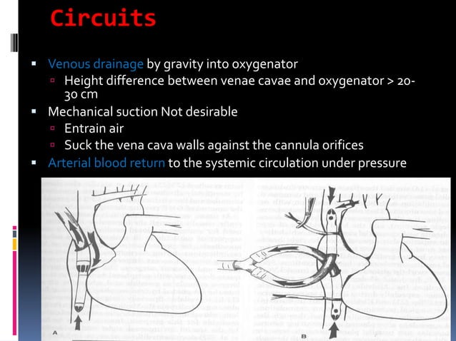 Principles of CPB | PPTX | Heart and Cardiovascular Diseases | Diseases ...
