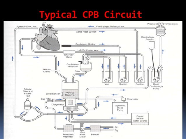 Principles of CPB | PPTX | Heart and Cardiovascular Diseases | Diseases ...