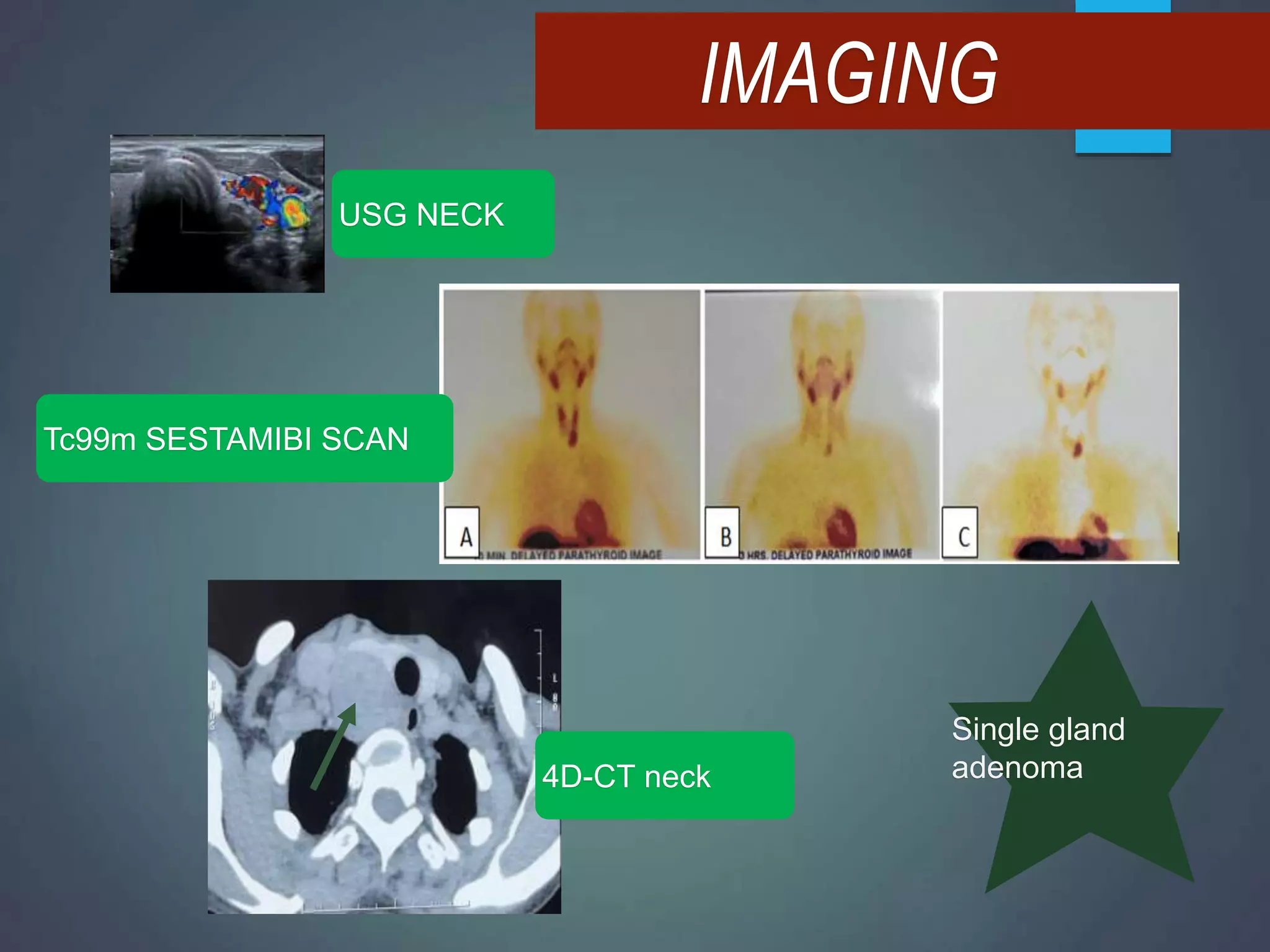 Parathyroid gland anatomy, its disorders and manangement | PPT