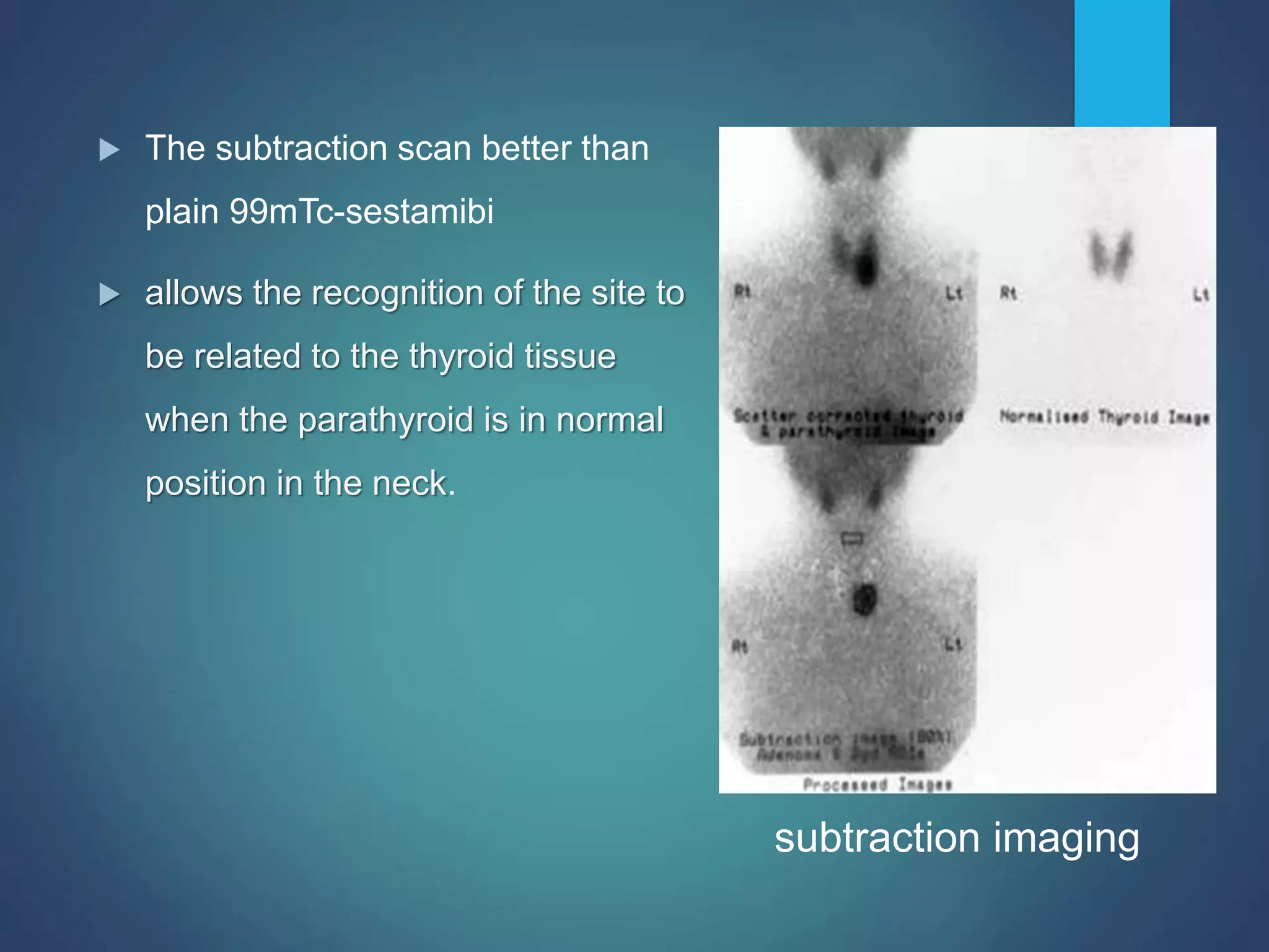 Parathyroid gland anatomy, its disorders and manangement | PPT