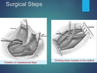 Parathyroid gland anatomy, its disorders and manangement | PPT