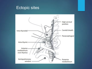 Parathyroid gland anatomy, its disorders and manangement | PPT
