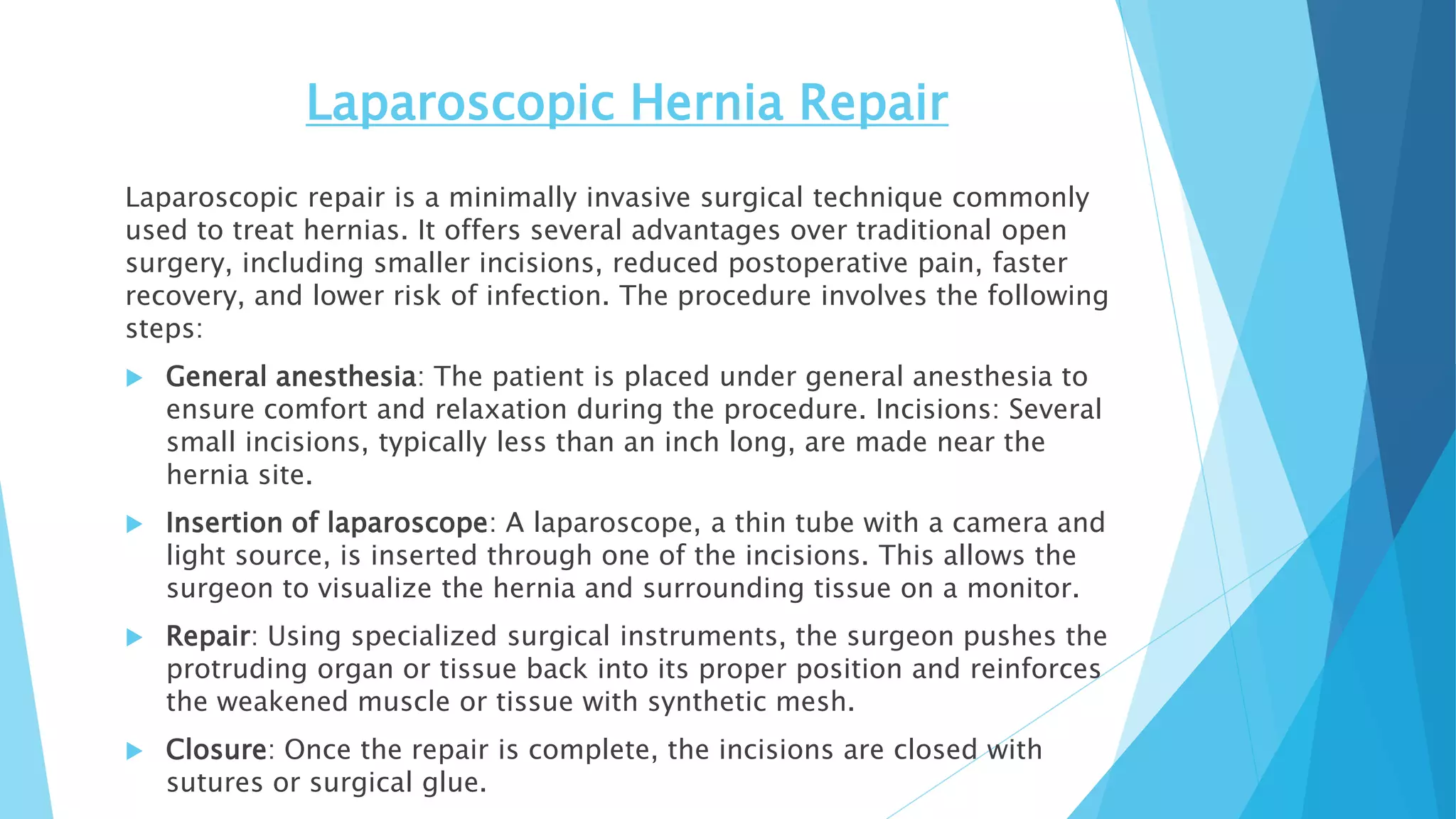 Hernias: Types, Symptoms and Laparoscopic Repair | PPT