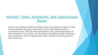 Hernias: Types, Symptoms and Laparoscopic Repair | PPT