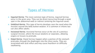 Hernias: Types, Symptoms and Laparoscopic Repair | PPT