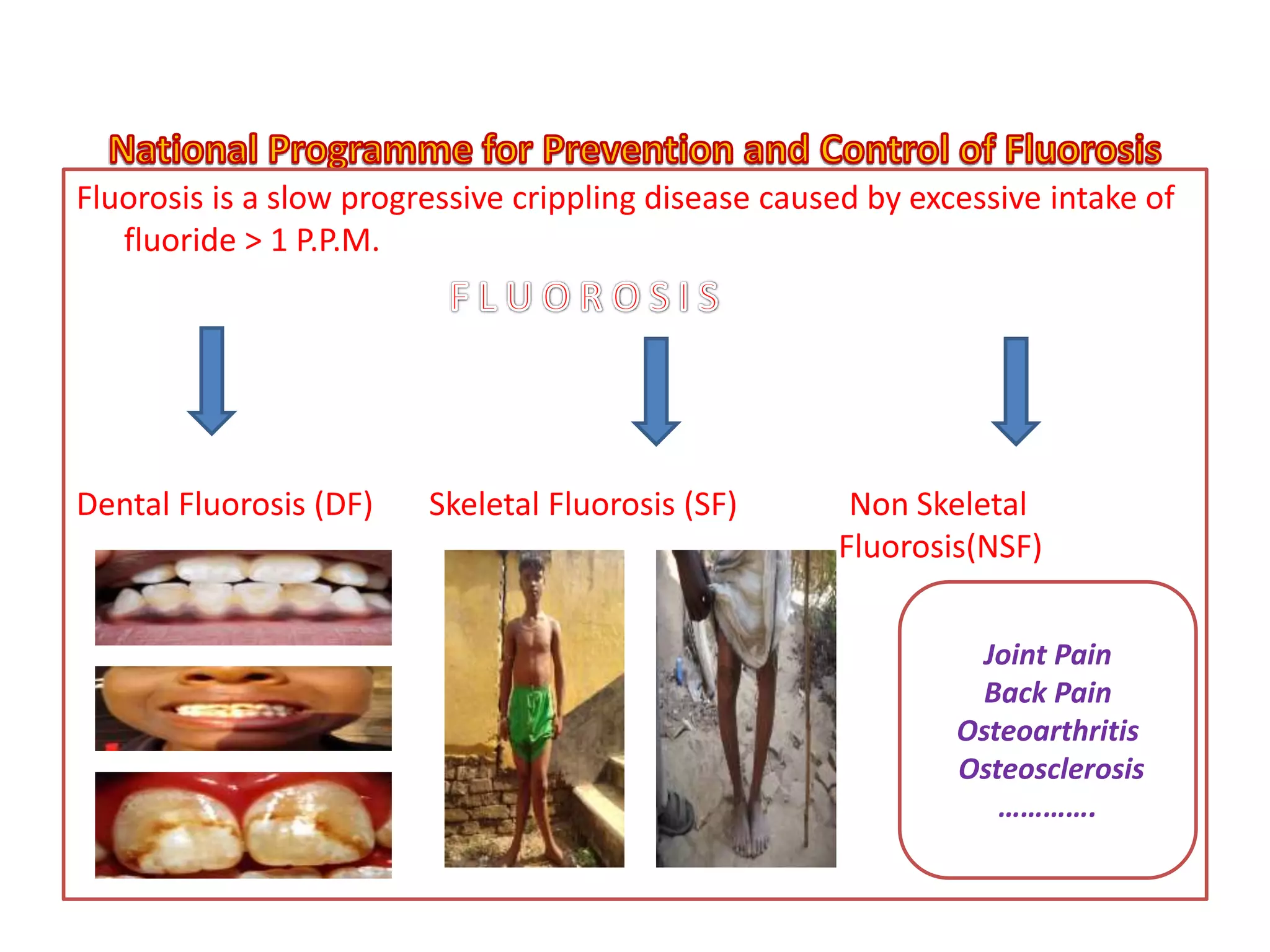 Dr dutta nppcf fluorosis_2nd half | PPTX