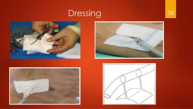 Chest Tube Dressing