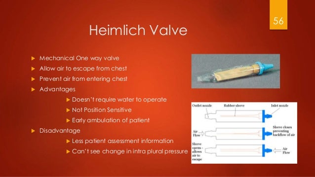 Tube Thoracostomy DR ELLAHI BAKHSH