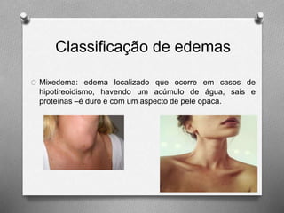 Drenagem Linfática - Introdução e Revisão - 1.pptx