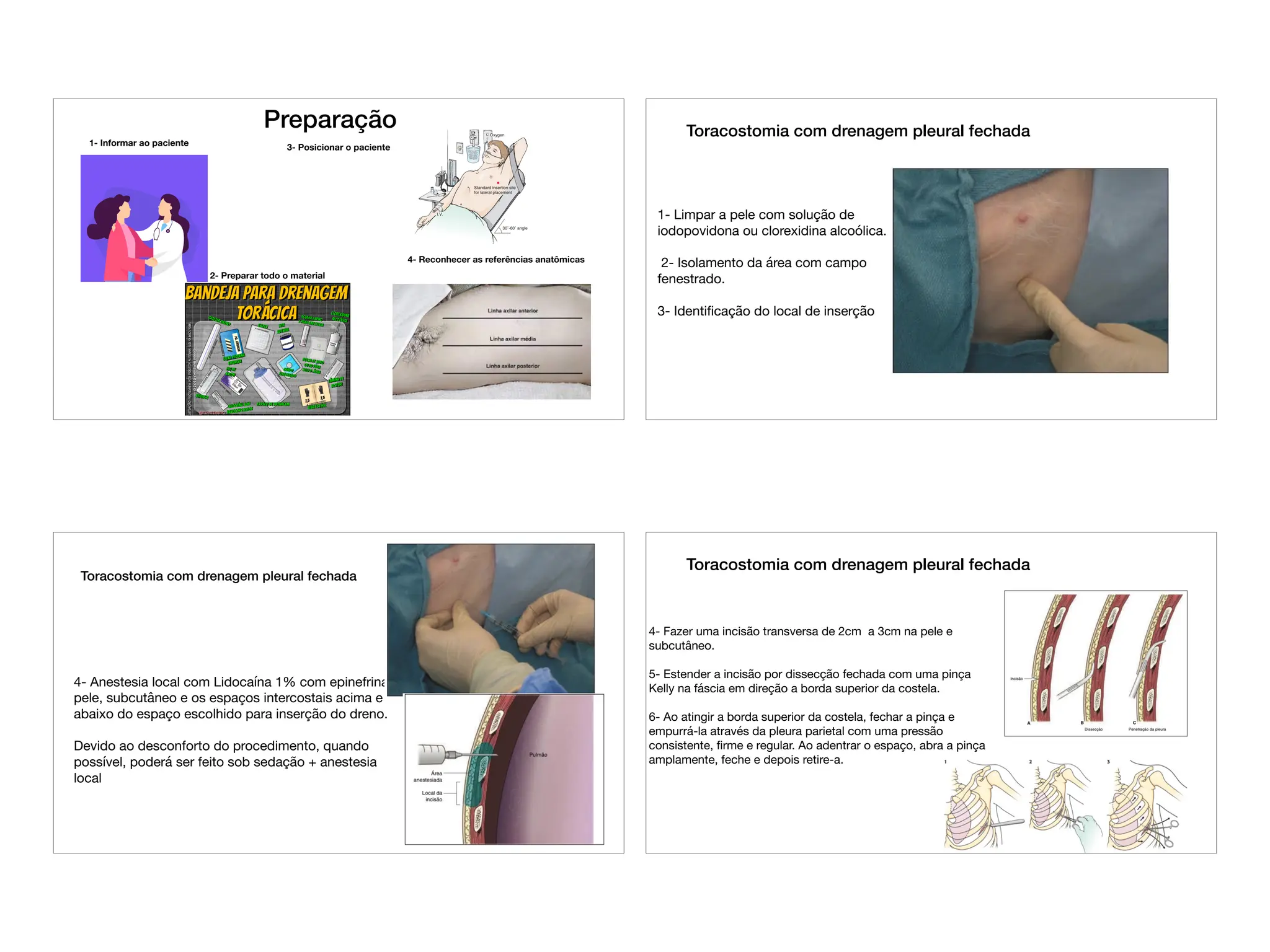 Drenagem torácica - métodos e técnicas de aplicação | PDF