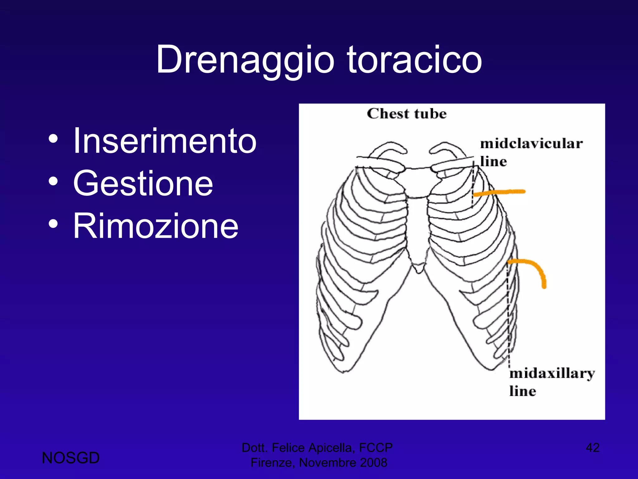 Il drenaggio toracico | PPT