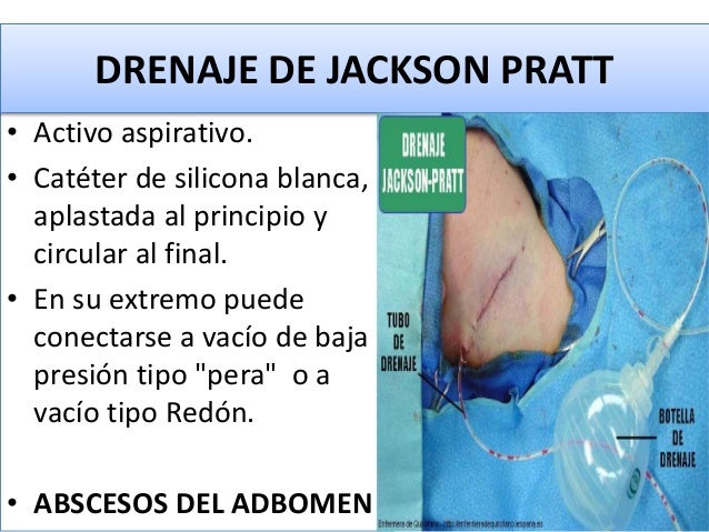 Drenajes Planos Tipo Jackson Pratt Ortopediasonlinecom