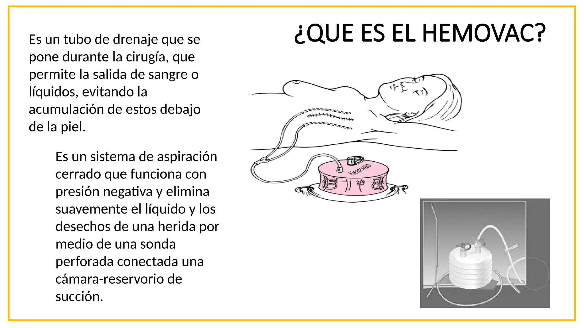 Drenaje-Hemovac-y-Penrose.pptxEs un sistema de aspiración cerrado que ...