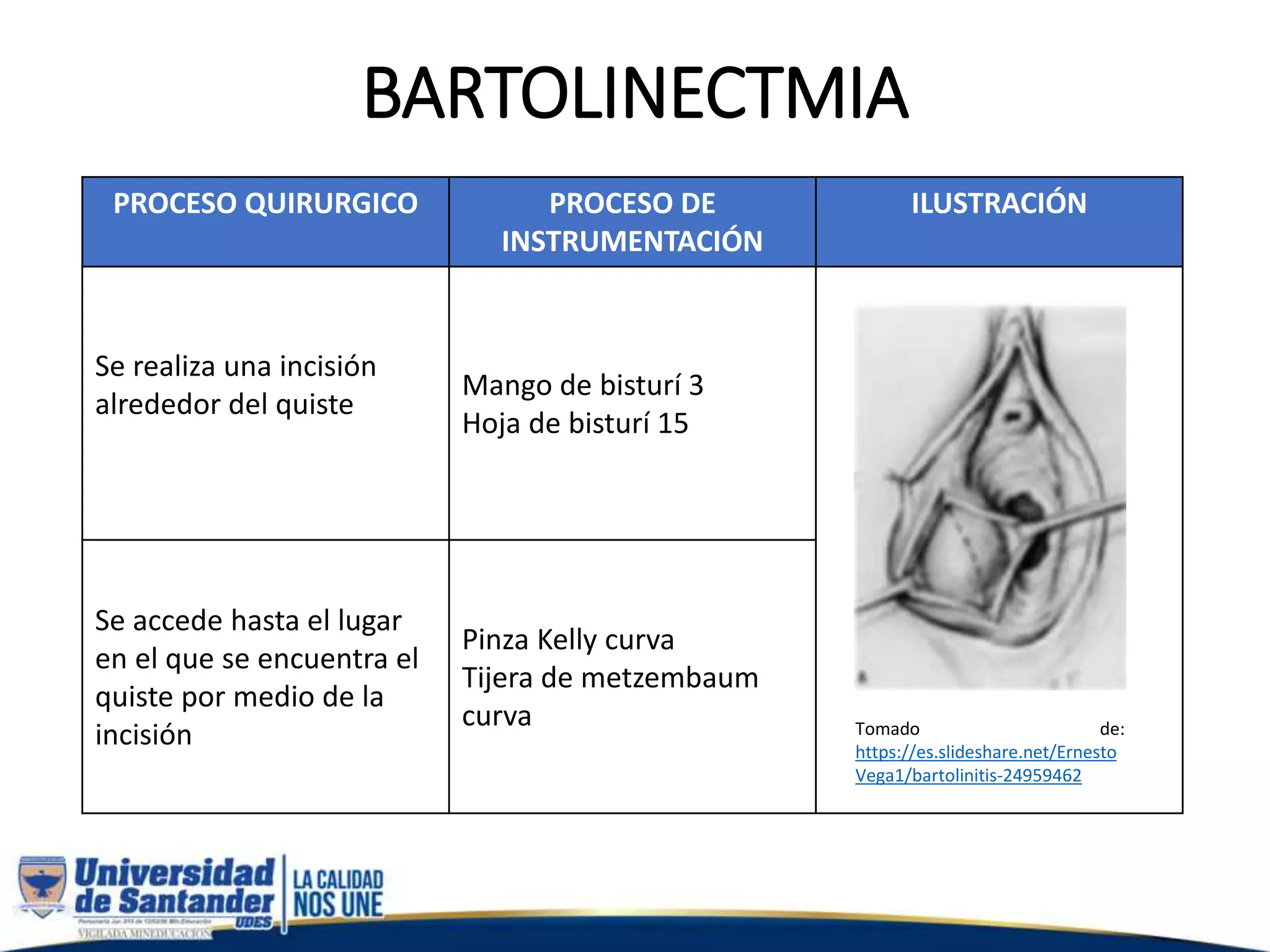 Drenaje, bartolinectomia | PPTX
