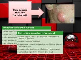 Drenaje de abscesos | PPTX