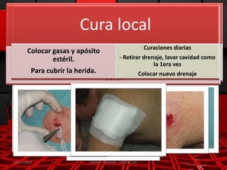 Drenaje de abscesos | PPTX
