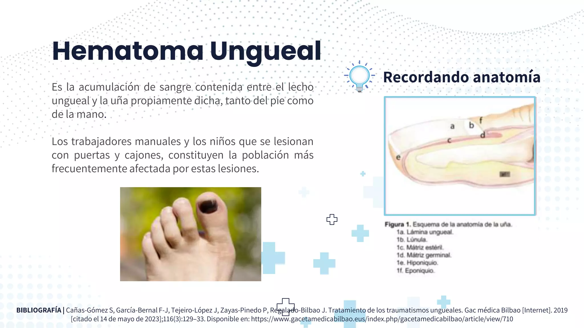 Drenaje de hematoma subungueal.pptx