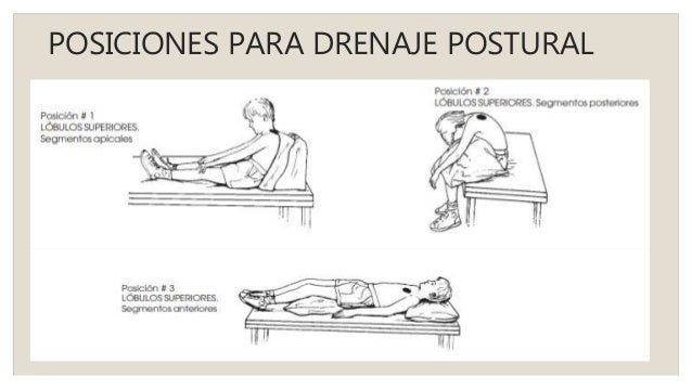 Drenaje postural