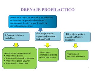 Drenajes | PPTX