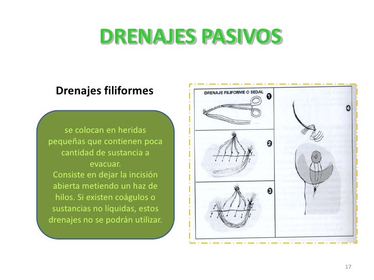 Drenajes
